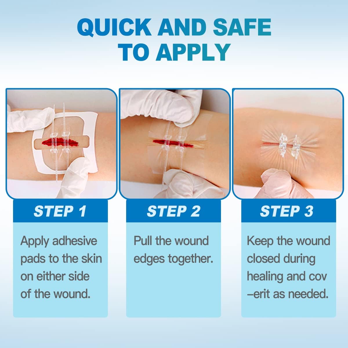 SENVOK - Advanced Wound Closure with Interlaced Locking Technology ...